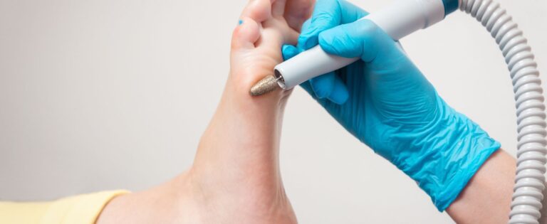 How a Chiropodist Helps in Treating Foot Infections - Dundas University ...